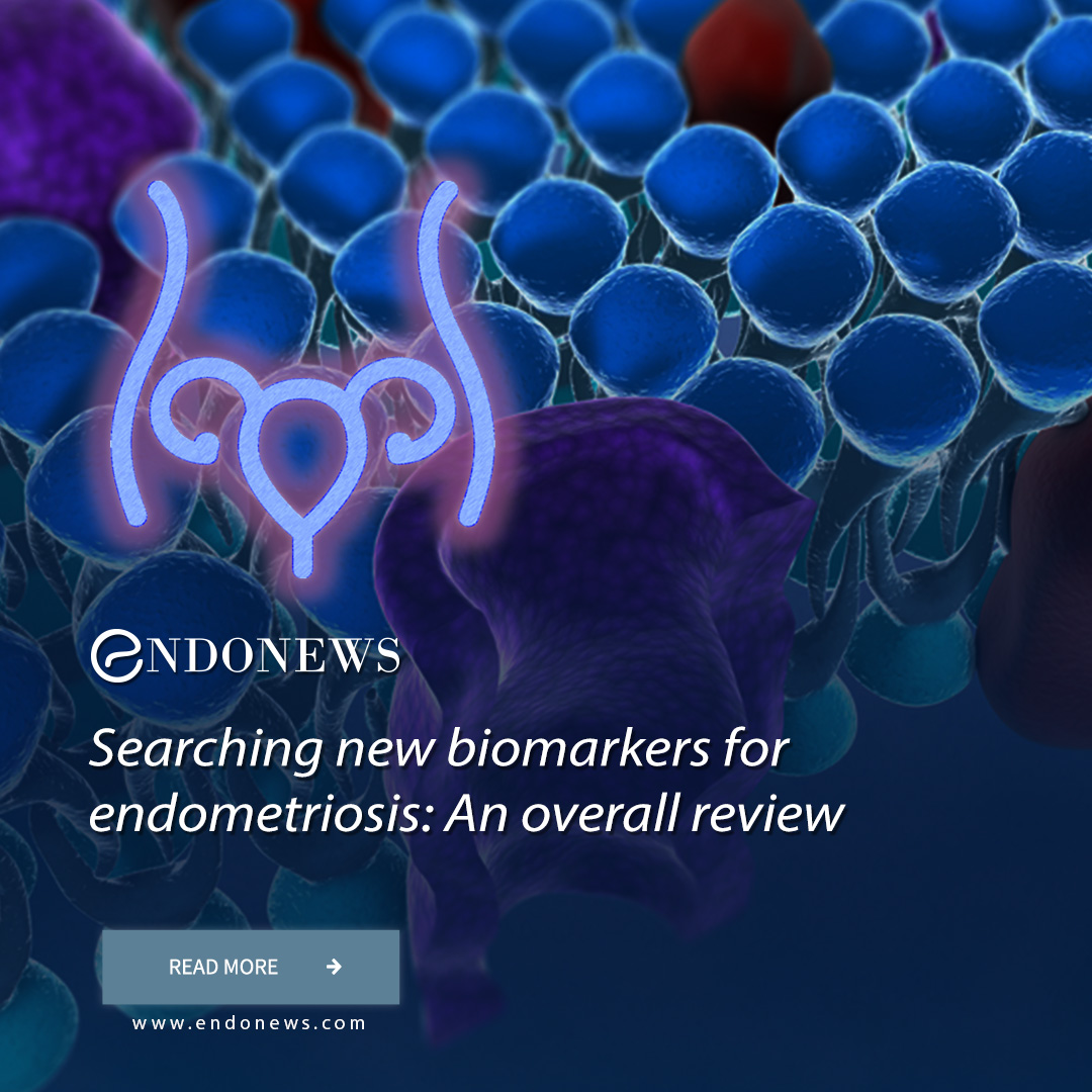 Searching new biomarkers for endometriosis | EndoNews