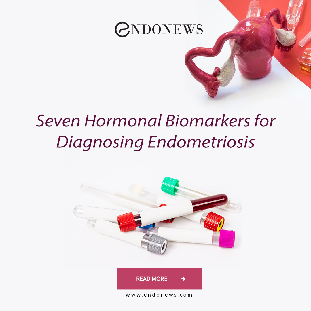 Seven Hormonal Biomarkers for Diagnosing Endometriosis | EndoNews