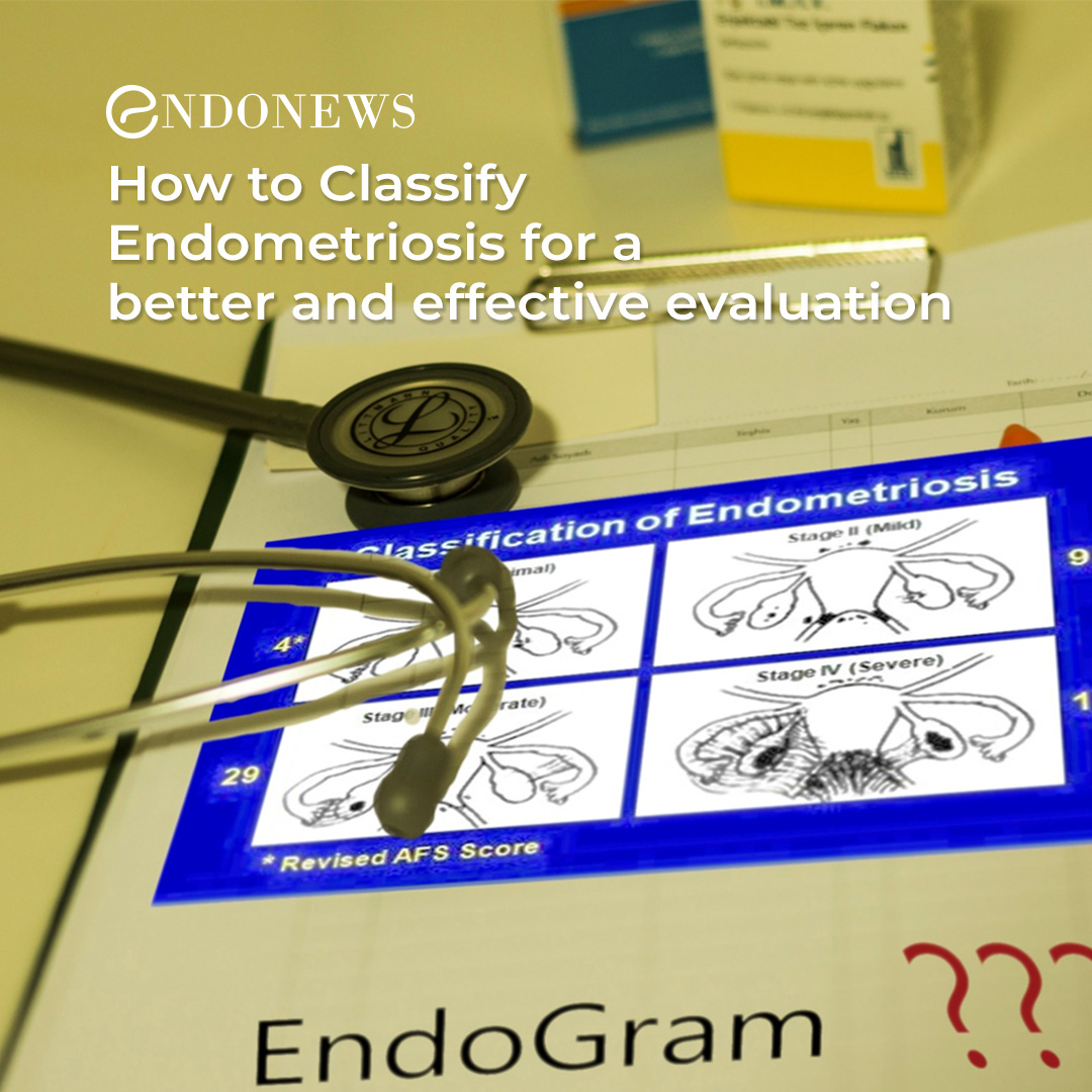 How to Classify Endometriosis for a better and effective evaluation ...