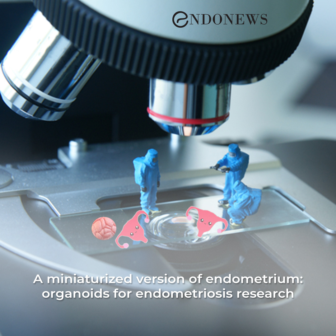 A miniaturized version of endometrium: organoids for endometriosis ...