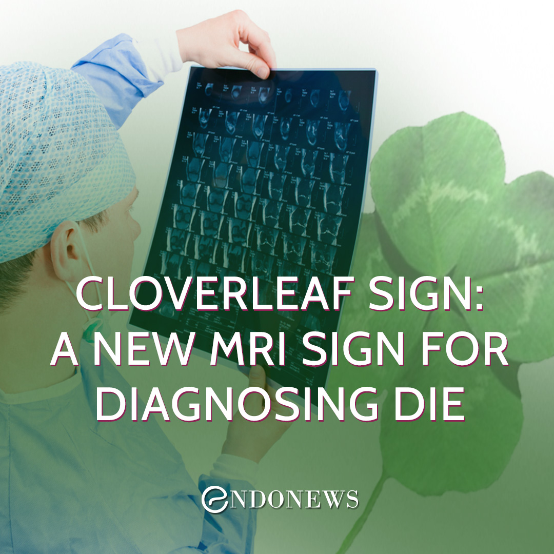 Cloverleaf Sign: A new MRI sign for diagnosing DIE | EndoNews
