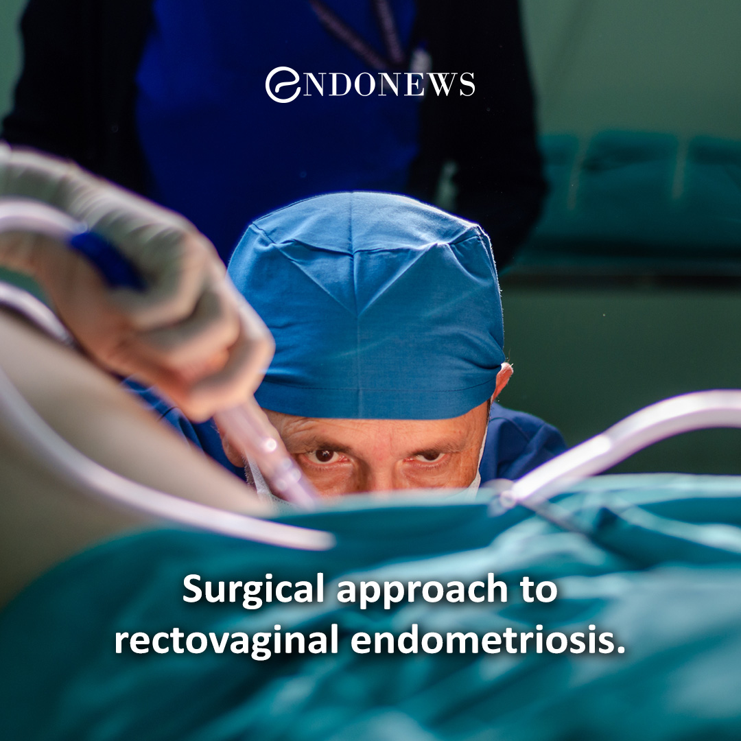 Surgical approach to rectovaginal endometriosis. | EndoNews