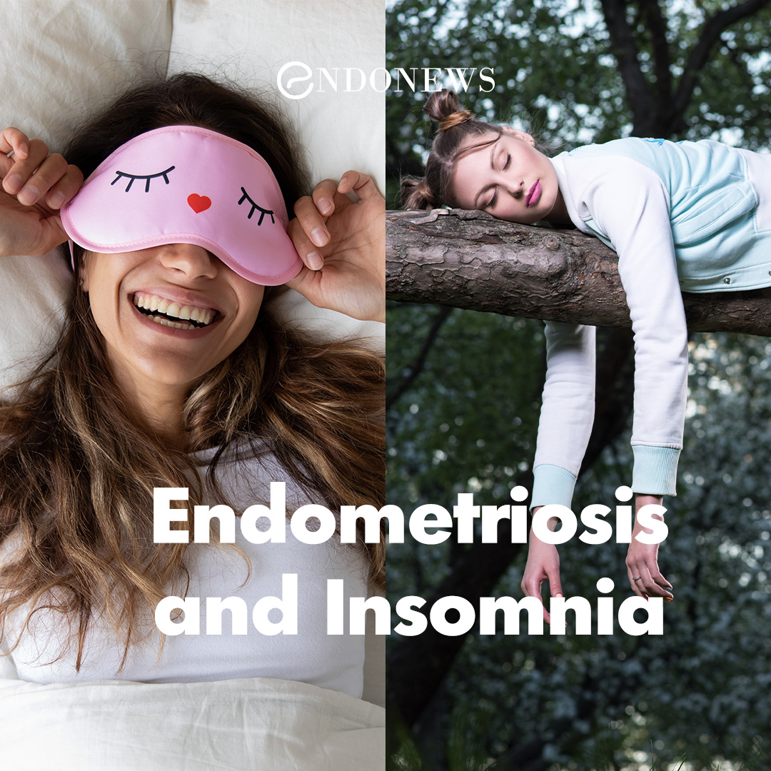 Endometriosis and Insomnia | EndoNews