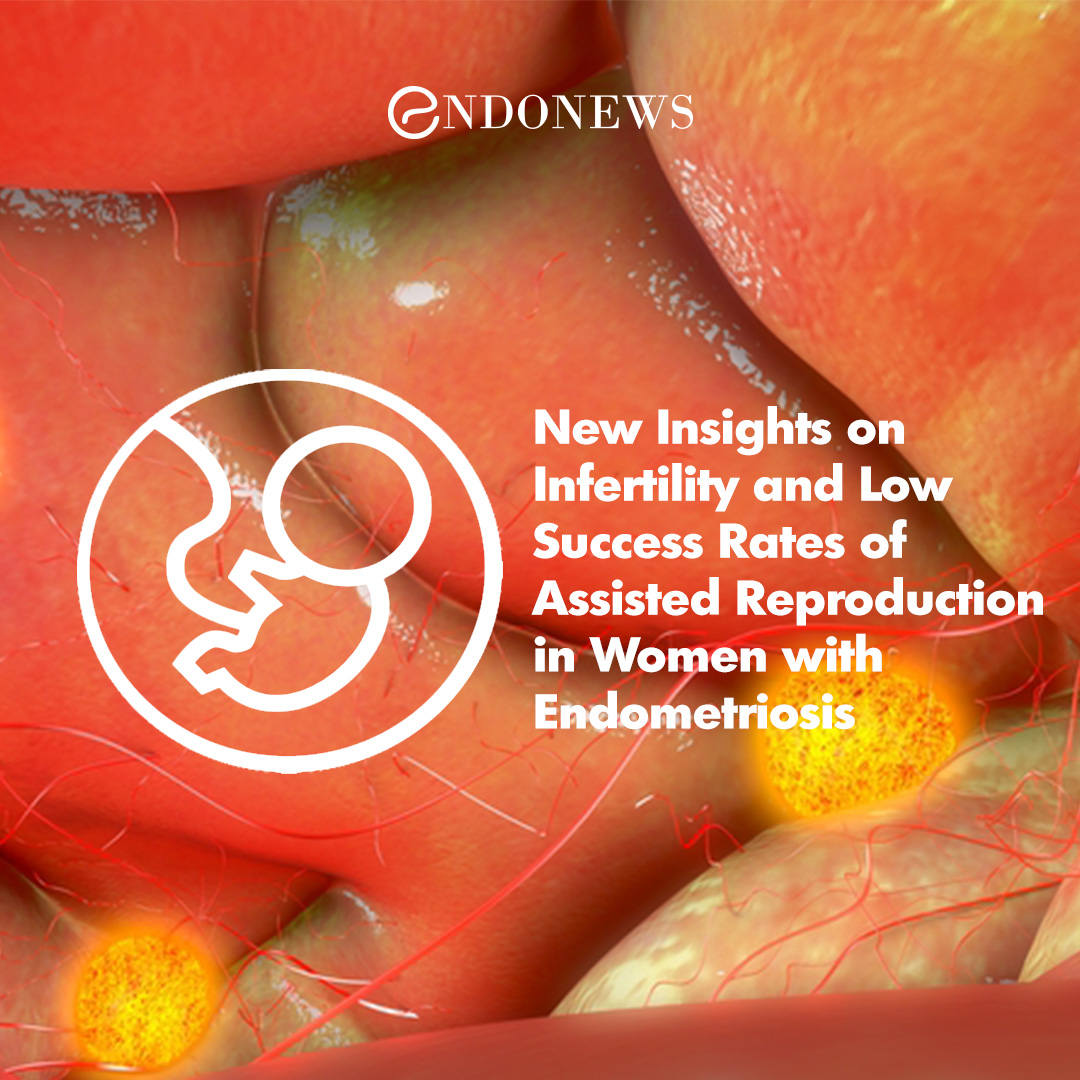 New Insights on Infertility and Low Success Rates of Assisted ...
