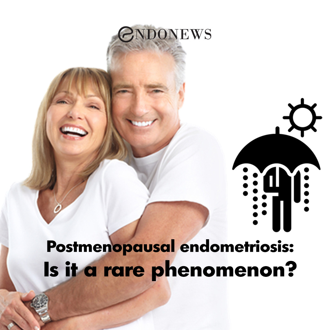 Postmenopausal endometriosis: Is it a rare phenomenon? | EndoNews