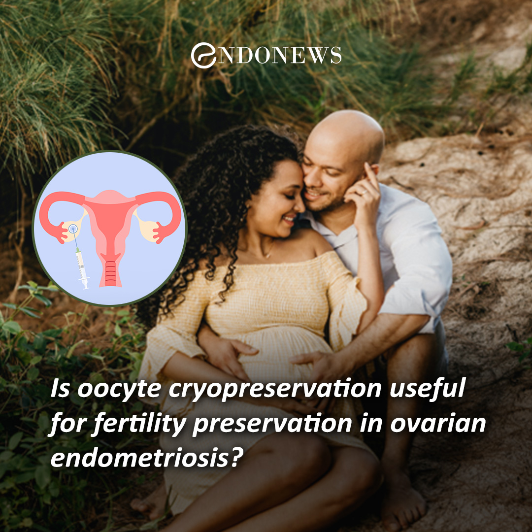 Is oocyte cryopreservation useful for fertility preservation in ovarian ...