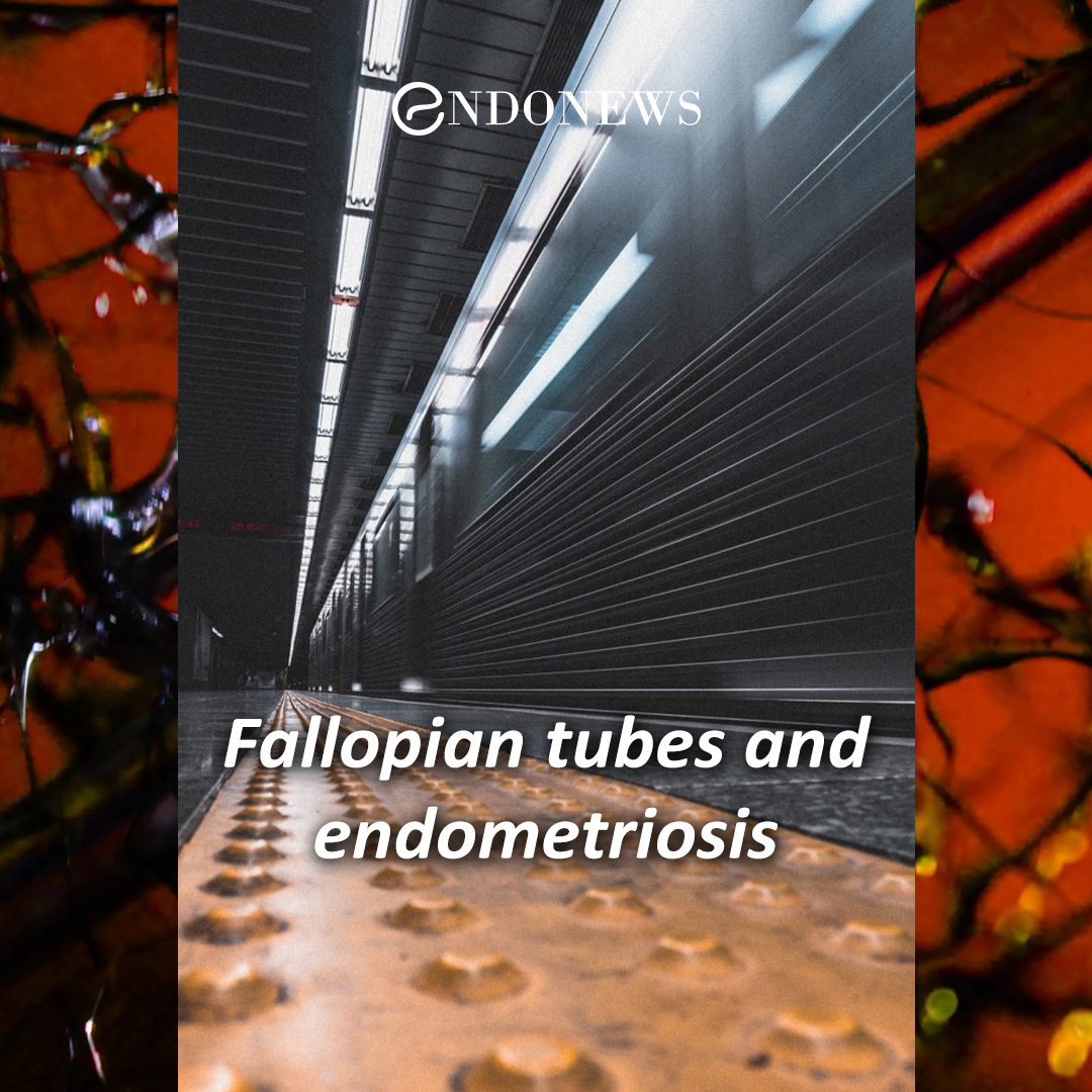 Fallopian tubes and endometriosis | EndoNews