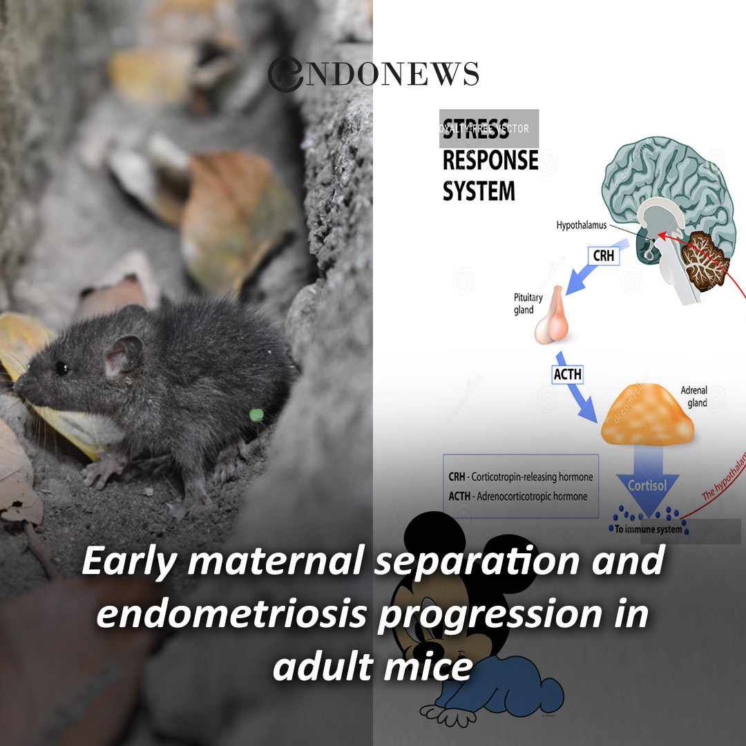 Early maternal separation and endometriosis progression in adult mice ...