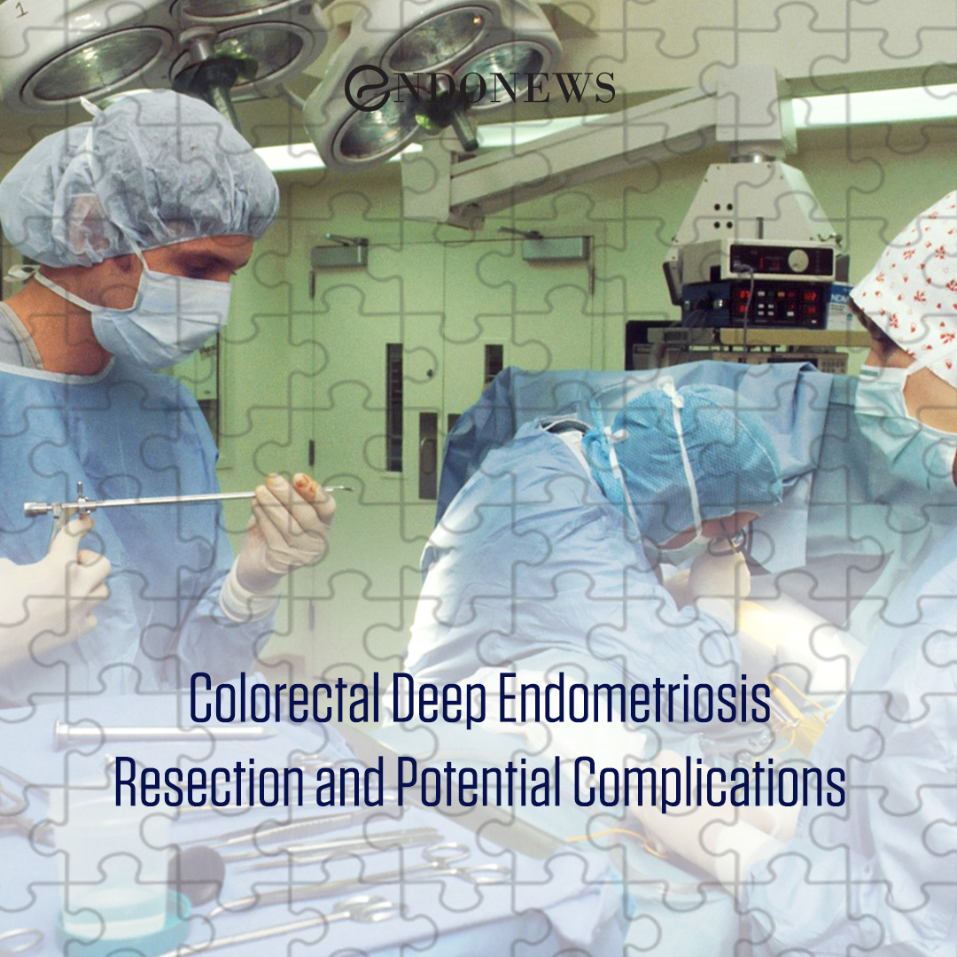 Colorectal Deep Endometriosis Resection and Potential Complications ...