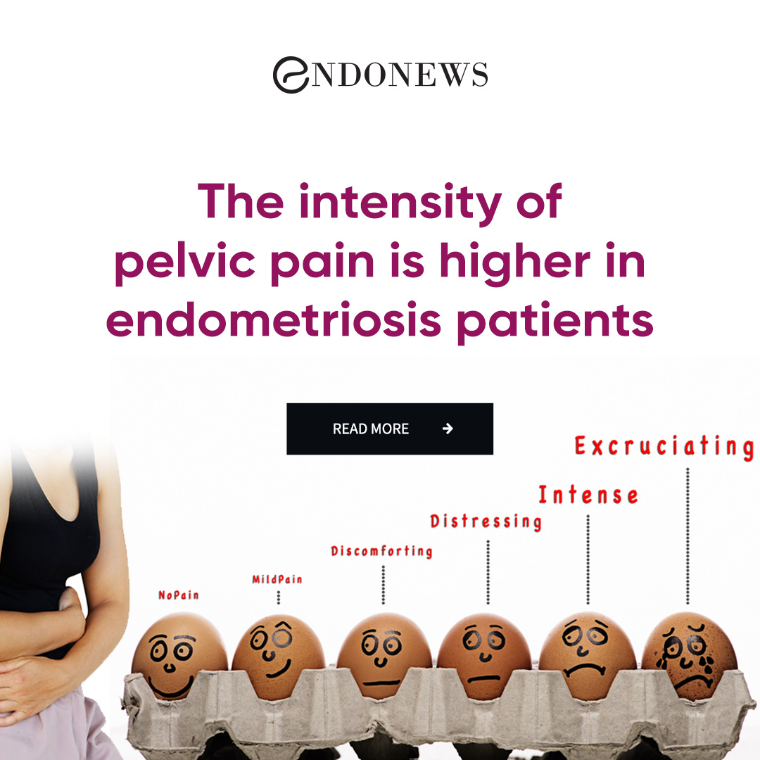 Endometriosis Pain
