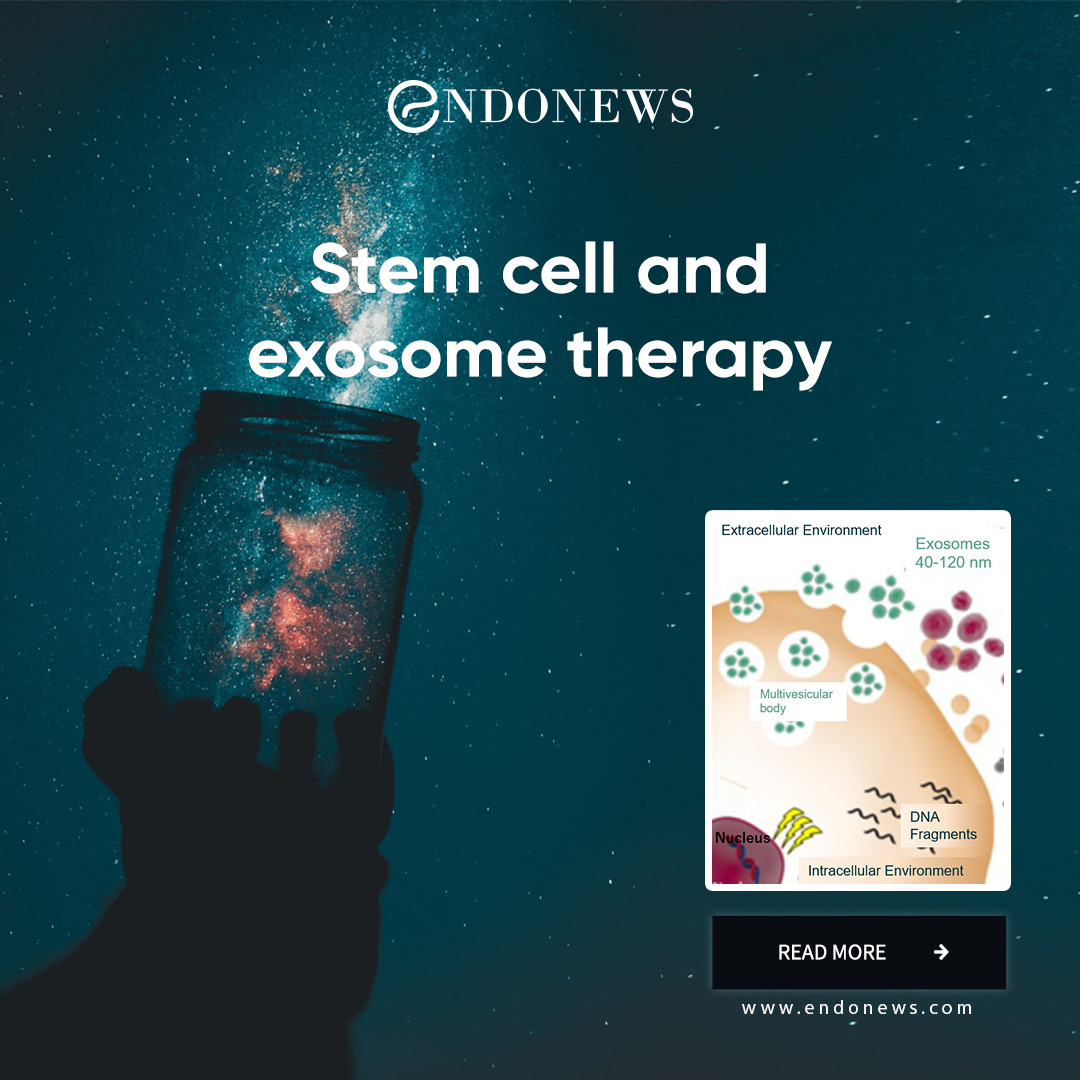 Stem Cell And Exosome Therapy Endonews
