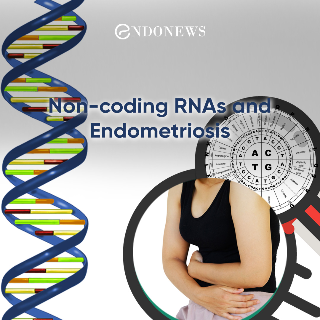 Non-coding RNAs and Endometriosis | EndoNews