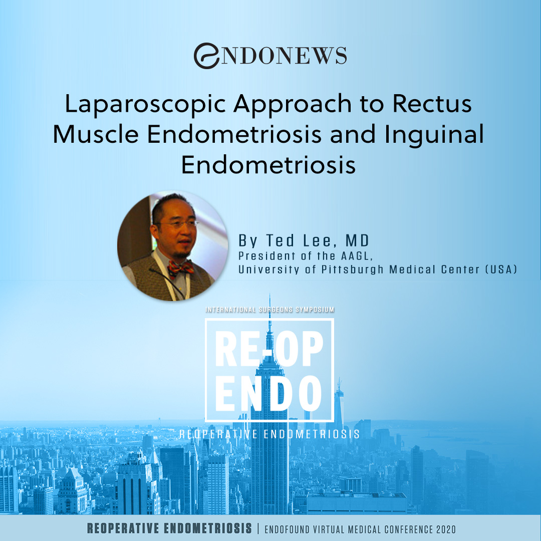 Laparoscopic Approach to Rectus Muscle Endometriosis and Inguinal ...