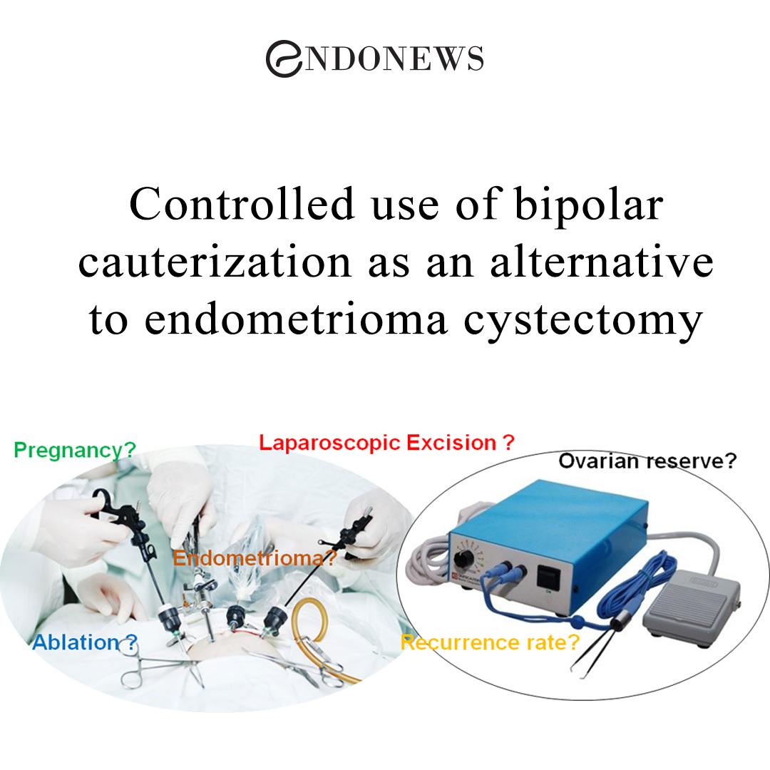 Controlled use of bipolar cauterization as an alternative to ...