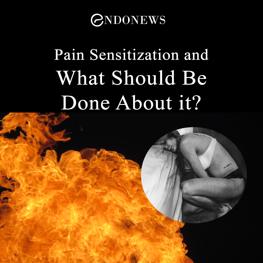Pain Sensitization and What Should Be Done About it? | EndoNews
