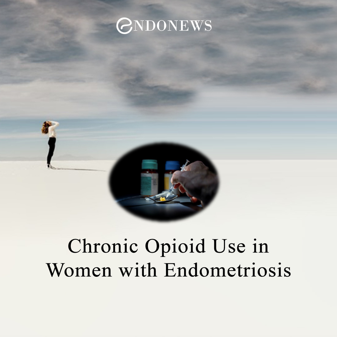 Chronic Opioid Use in Women with Endometriosis | EndoNews