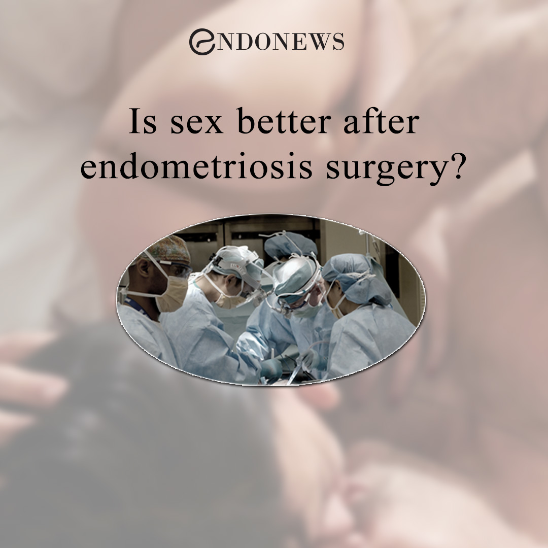 Endometriosis Surgery Improves Sex Life Endonews