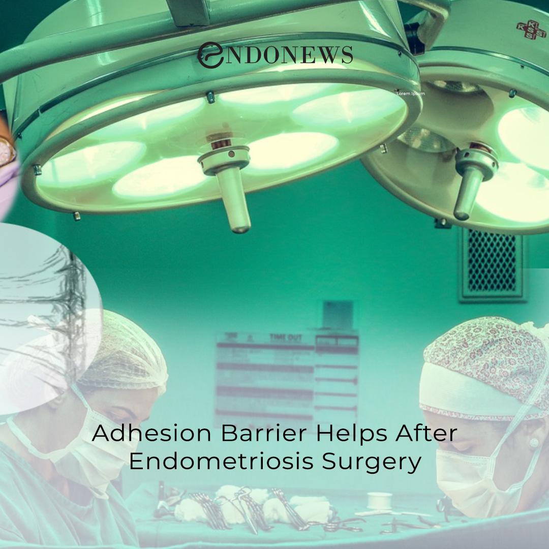 Adhesion Barrier Surgery at Jonathan Baylee blog