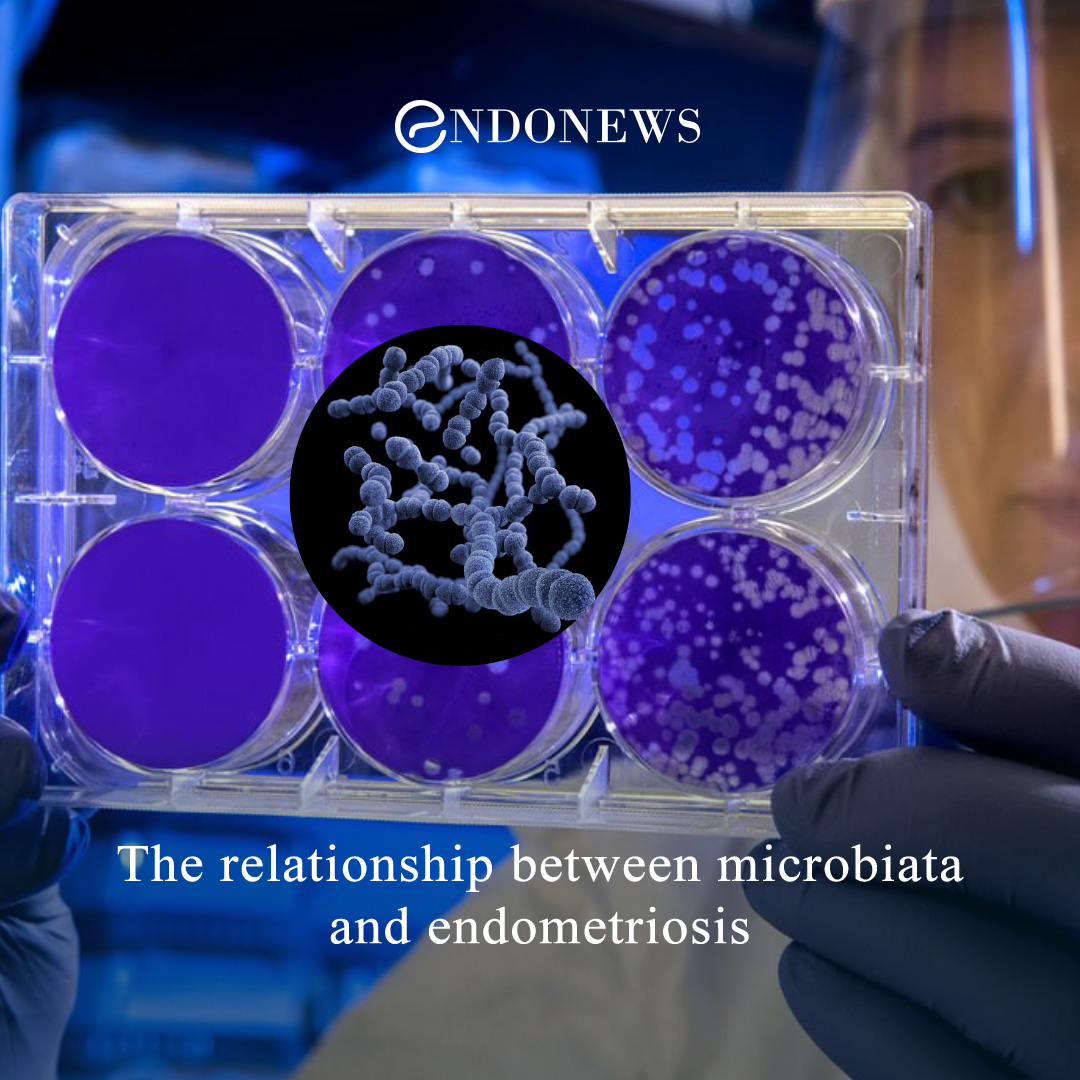 The relationship between microbiota and endometriosis | EndoNews The relationship between microbiota and endometriosis | EndoNews