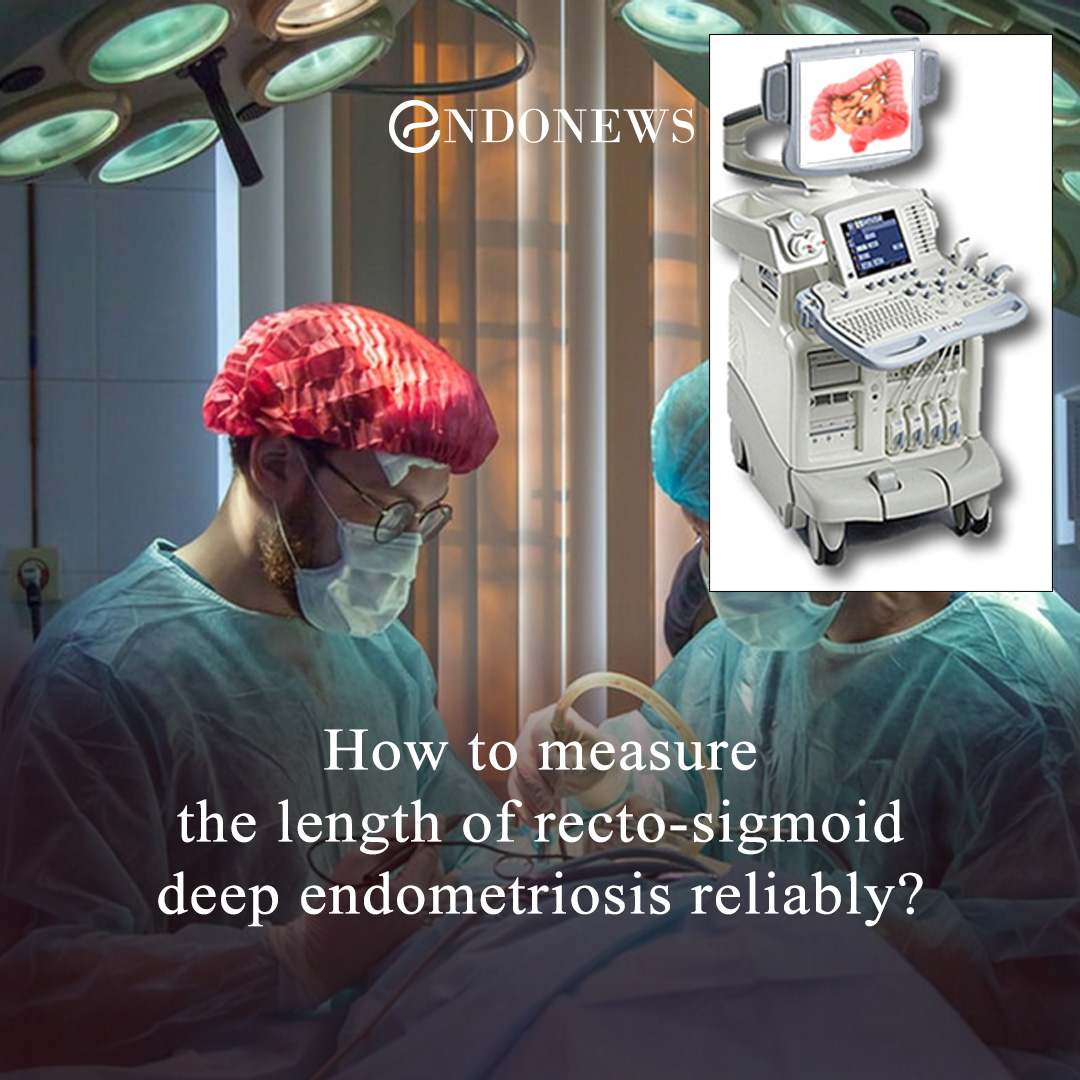 How to measure the length of recto-sigmoid deep endometriosis reliably ...