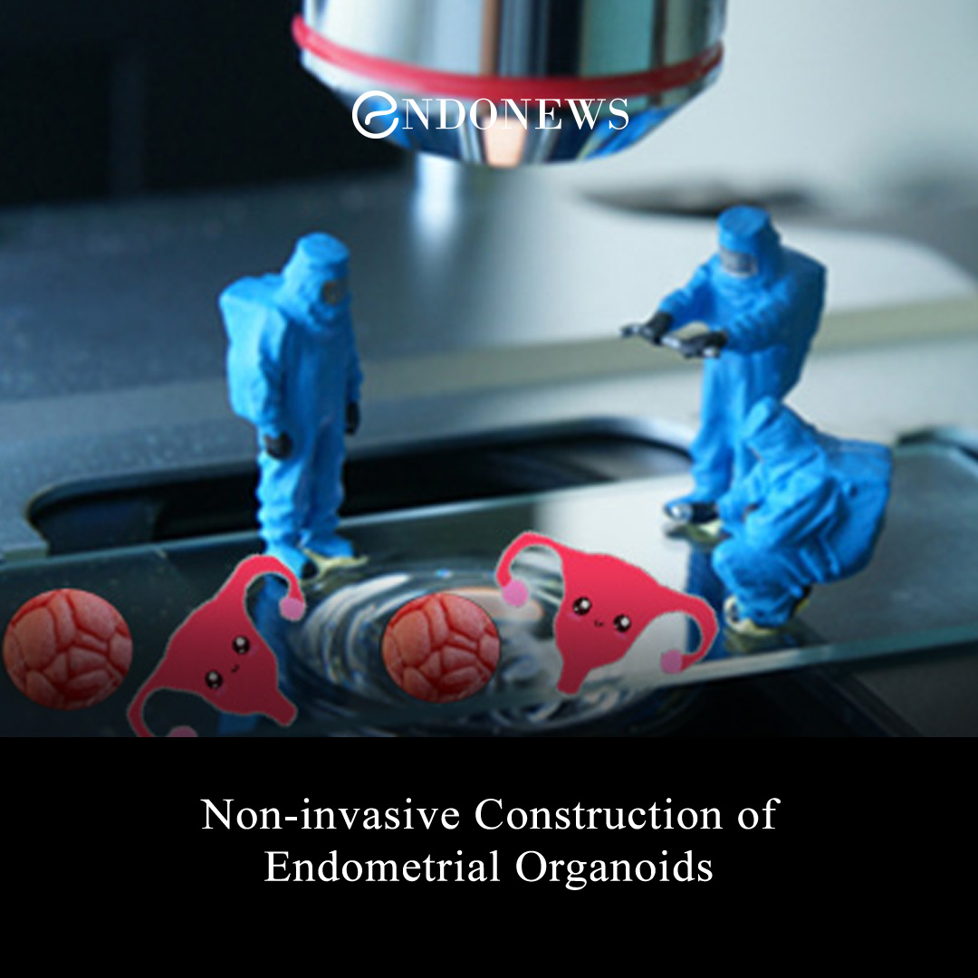 Non-invasive Construction of Endometrial Organoids | EndoNews