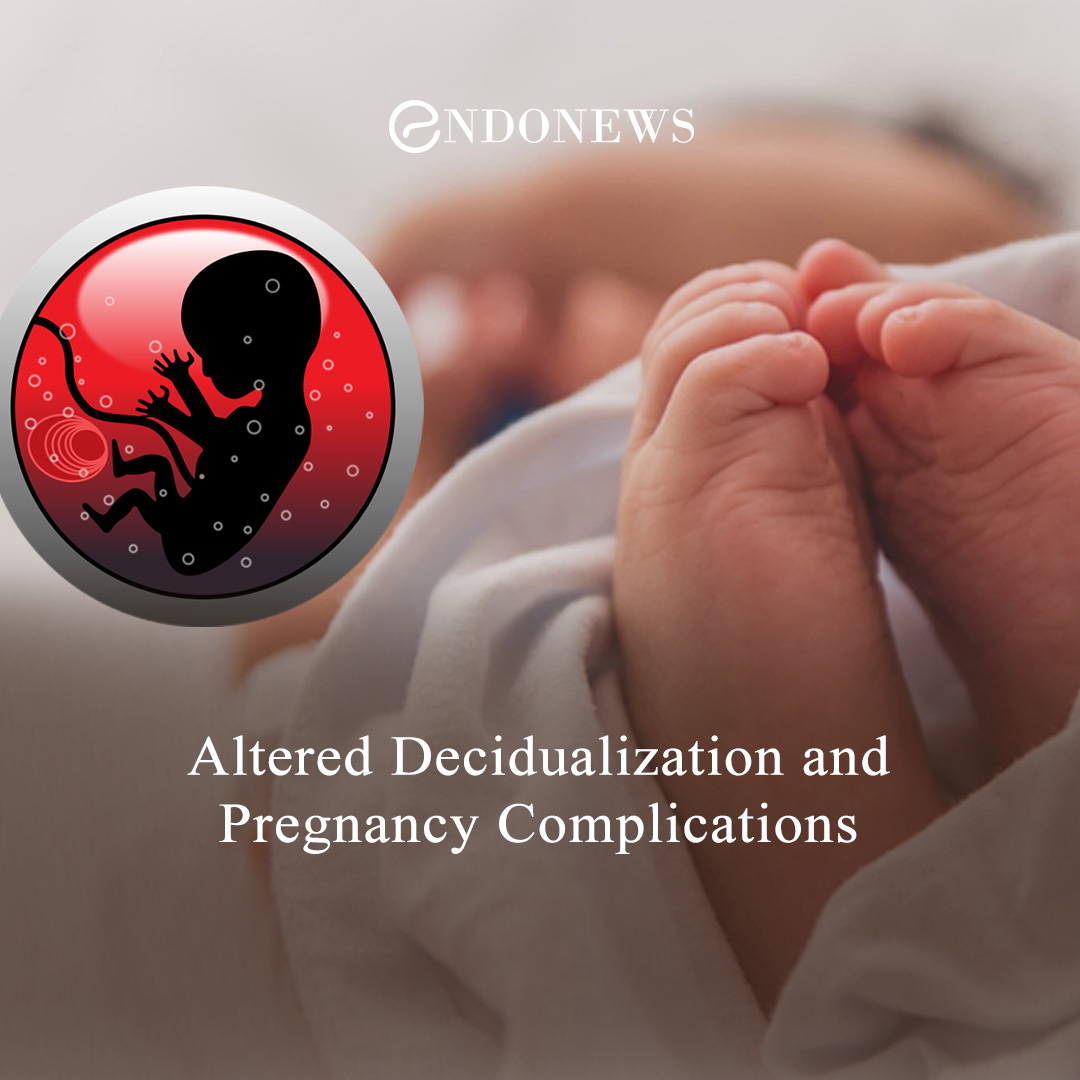 Altered Decidualization and Pregnancy Complications | EndoNews