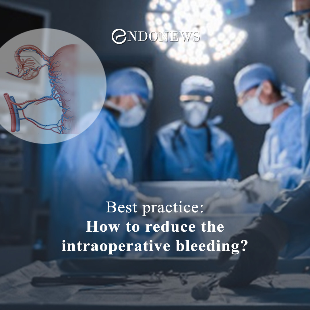 Best practice: How to reduce intraoperative bleeding? | EndoNews