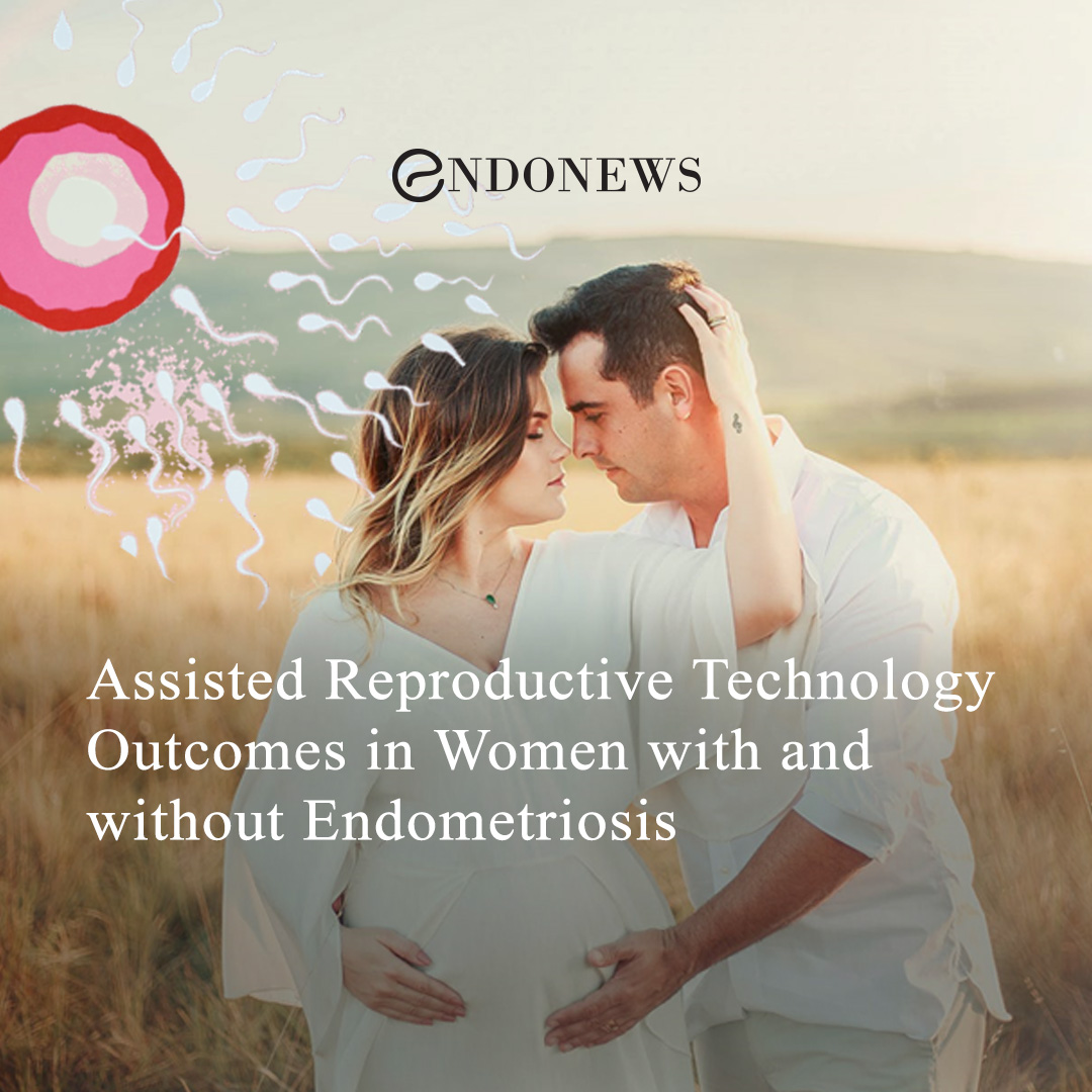 Assisted Reproductive Technology Outcomes in Women with and without ...