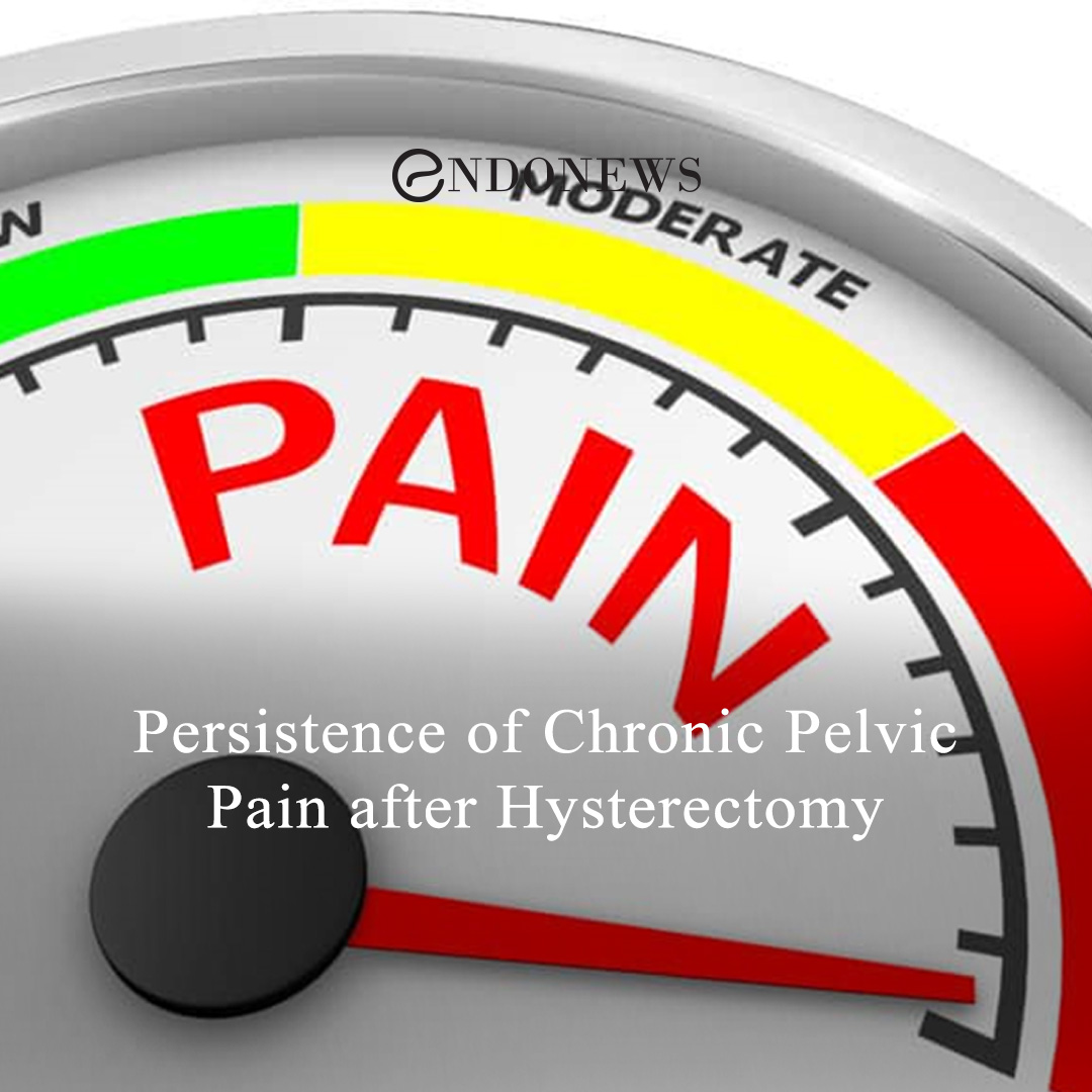 Persistence of Chronic Pelvic Pain after Hysterectomy | EndoNews