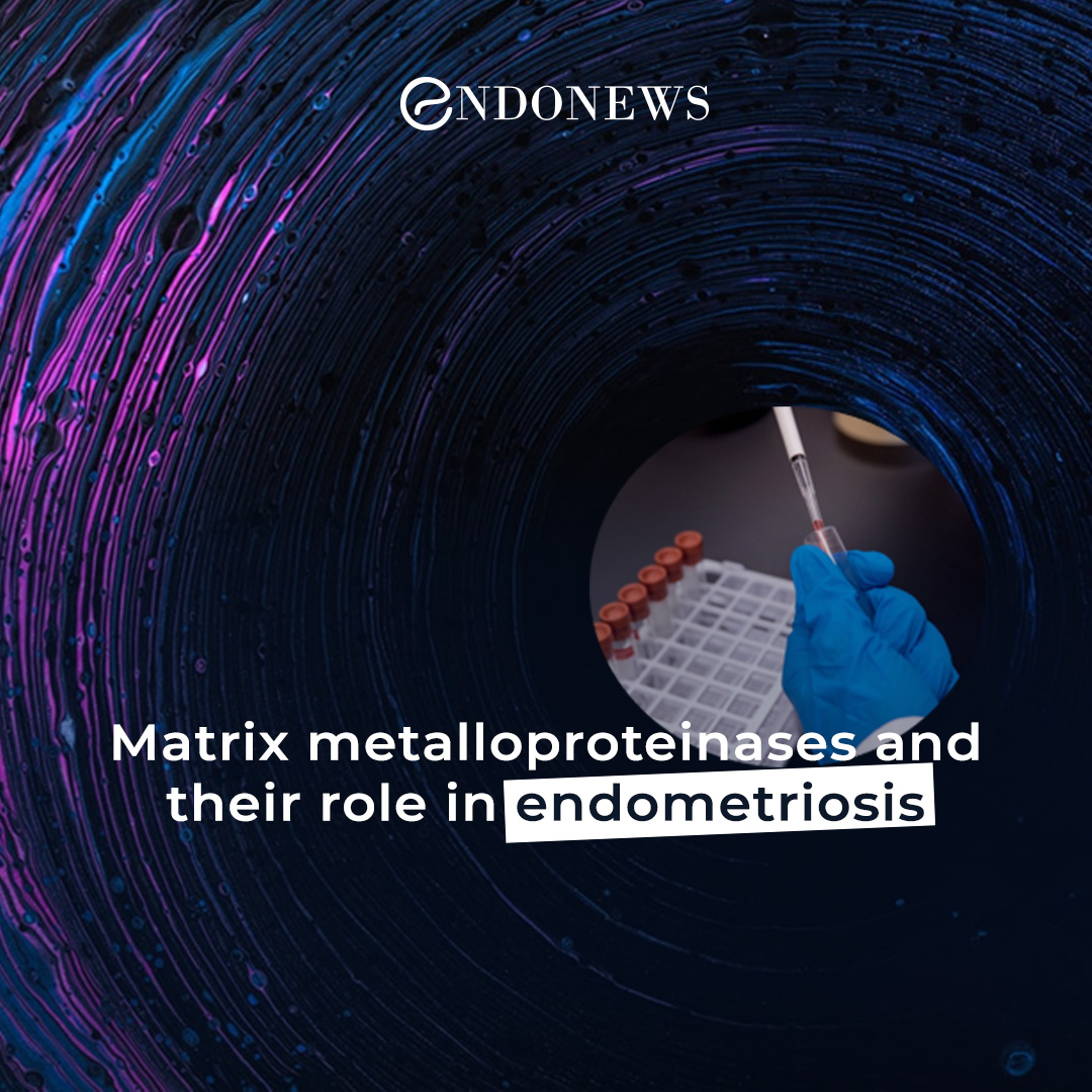 Matrix metalloproteinases and their role in endometriosis | EndoNews