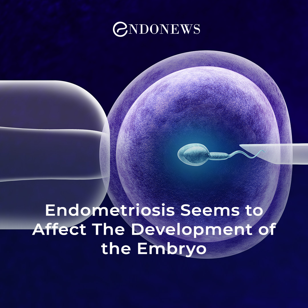Endometriosis Seems to Affect The Development of the Embryo | EndoNews