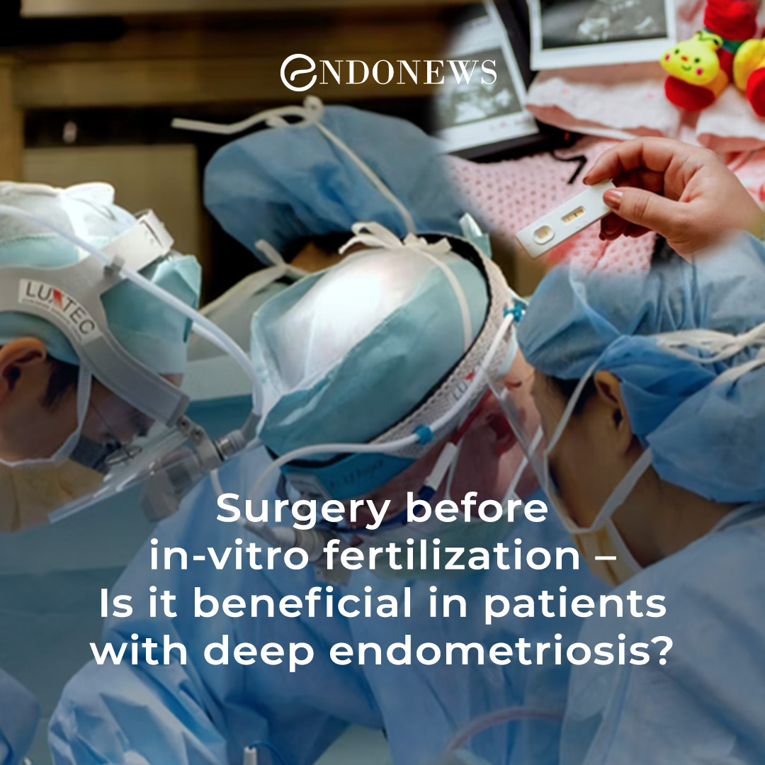 Surgery before in-vitro fertilization – Is it beneficial in patients ...