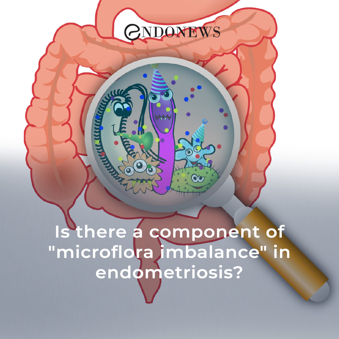 Is there a component of "microflora imbalance" in endometriosis? | EndoNews