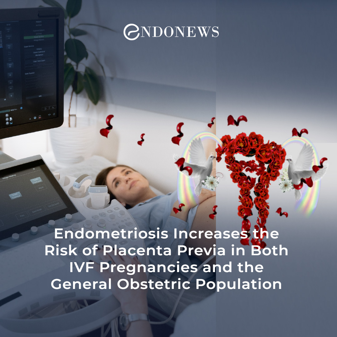Placenta Previa More Common Among Pregnant Women With Endometriosis ...