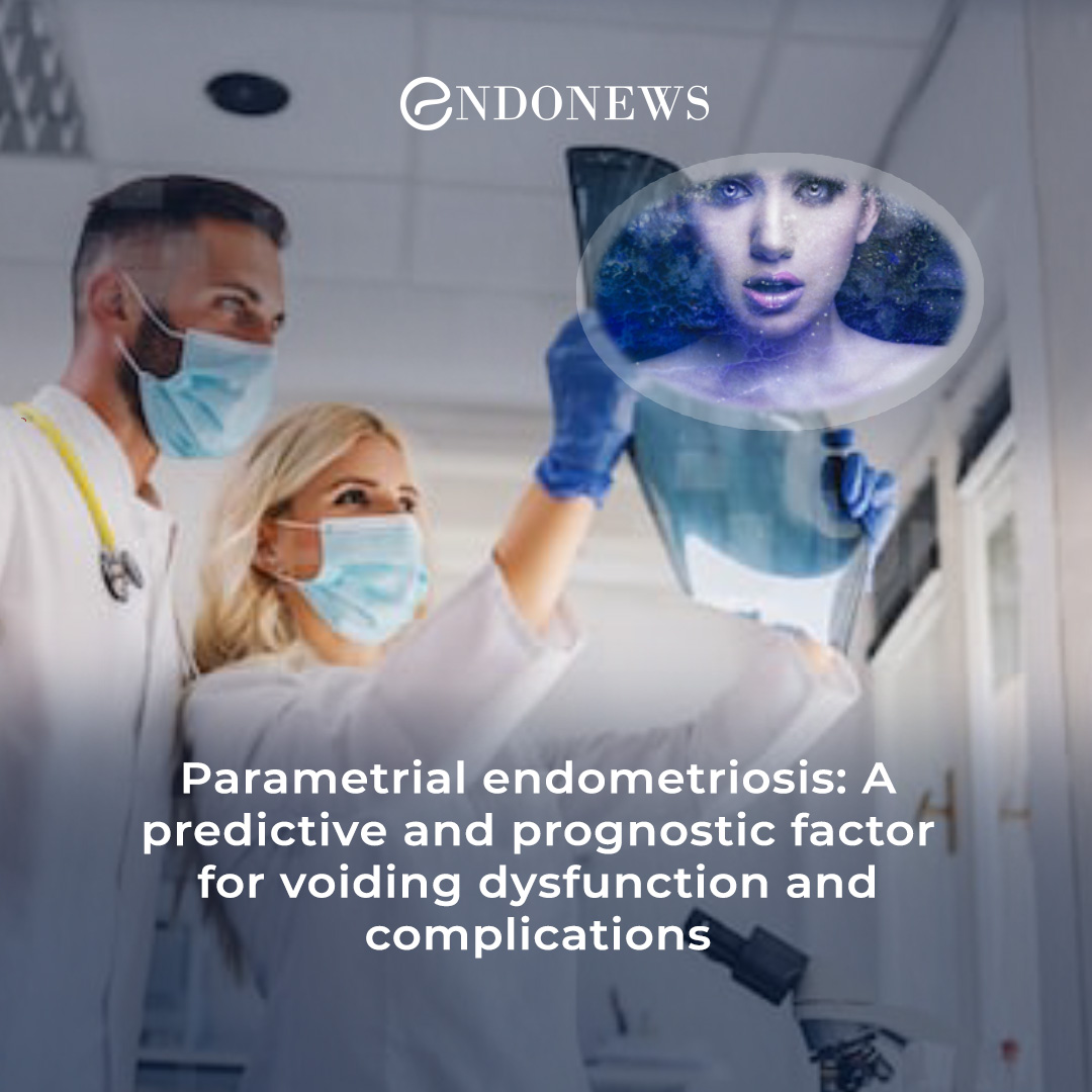 Parametrial endometriosis and postoperative voiding dysfunction. | EndoNews