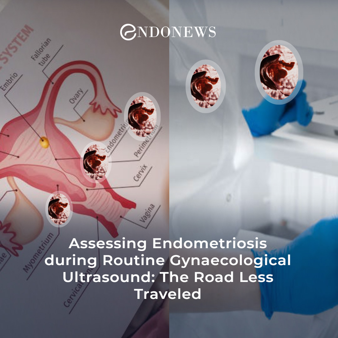 A prediction model to identify endometriosis during routine ultrasound ...