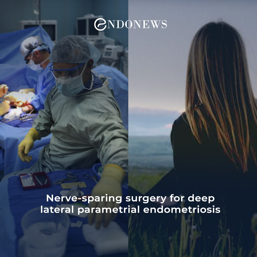 Deep lateral parametrial endometriosis nerve-sparing surgery | EndoNews