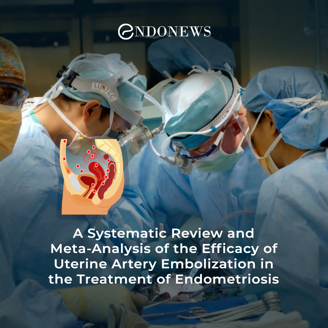 Efficacy of Uterine Artery Blockage in Endometriosis Management | EndoNews