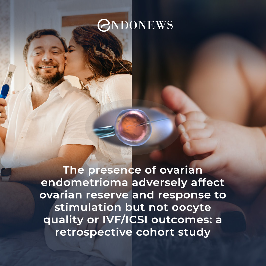 Ovarian endometriomas, ovarian reserve, oocyte quality and IVF/ICSI ...