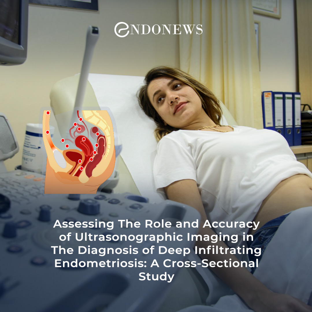 How accurate is ultrasonography in evaluating deep infiltrating ...