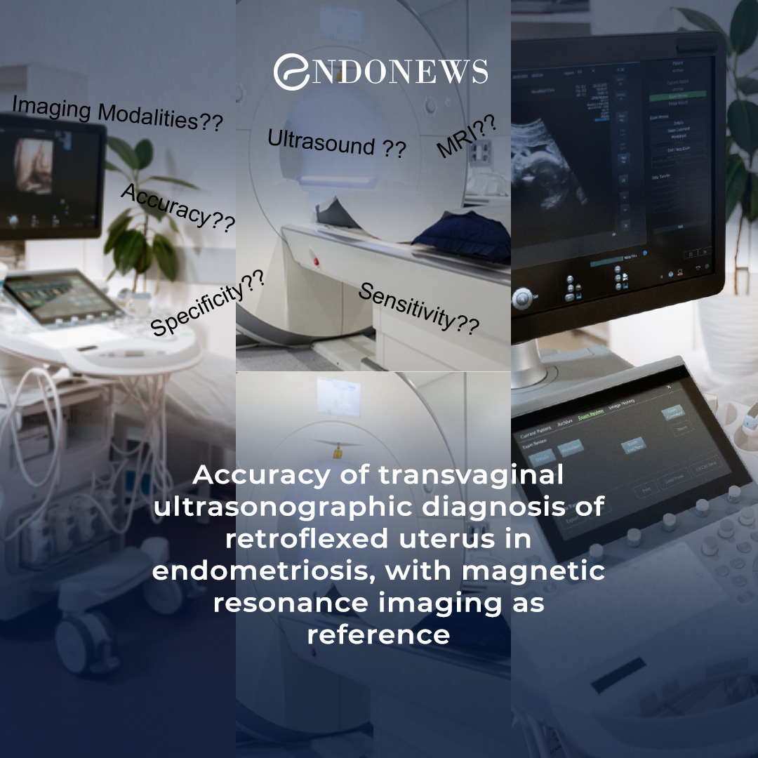 Transvaginal Ultrasound Or Mri For Retroflexed Uterus In Endometriosis