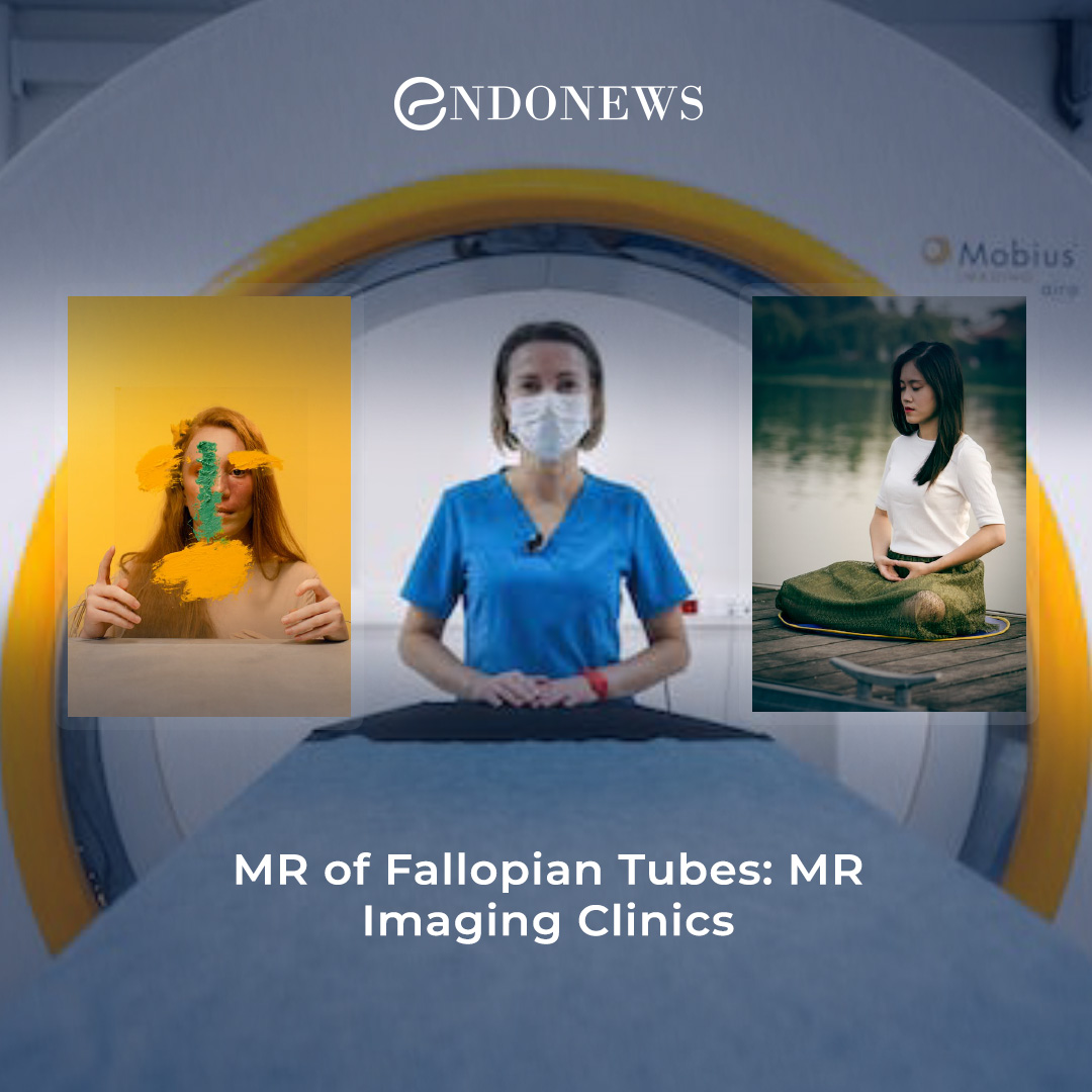 Imaging techniques for fallopian tubes | EndoNews