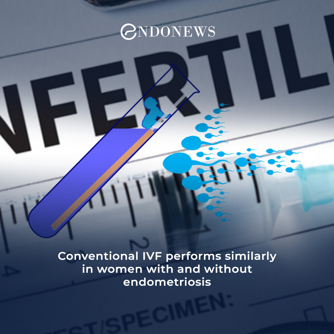 Conventional Ivf Or Icsi Which One Is More Accurate In Endometriosis