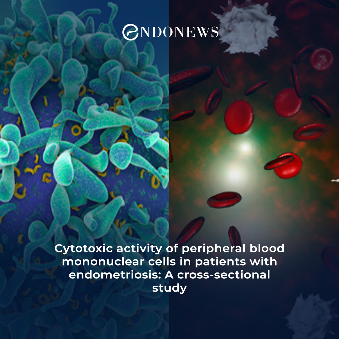 Activities of cytotoxic cells in endometriosis | EndoNews