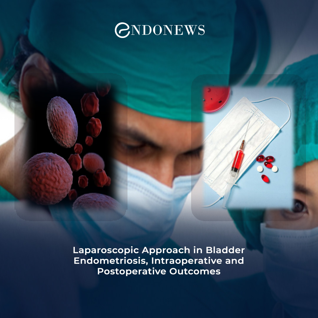 Laparoscopic resection of bladder endometriosis | EndoNews Laparoscopic resection of bladder endometriosis | EndoNews