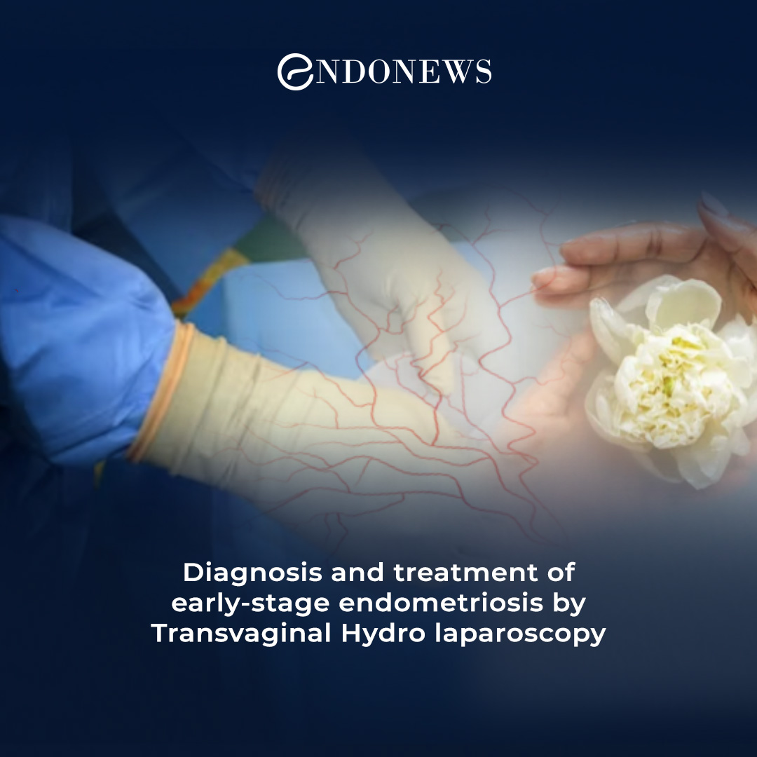 Transvaginal Hydro laparoscopy for diagnosing and treatment of early ...