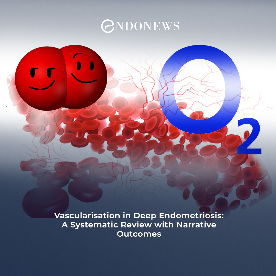 Unraveling The Role Of Vascularization In Deep Endometriosis Endonews