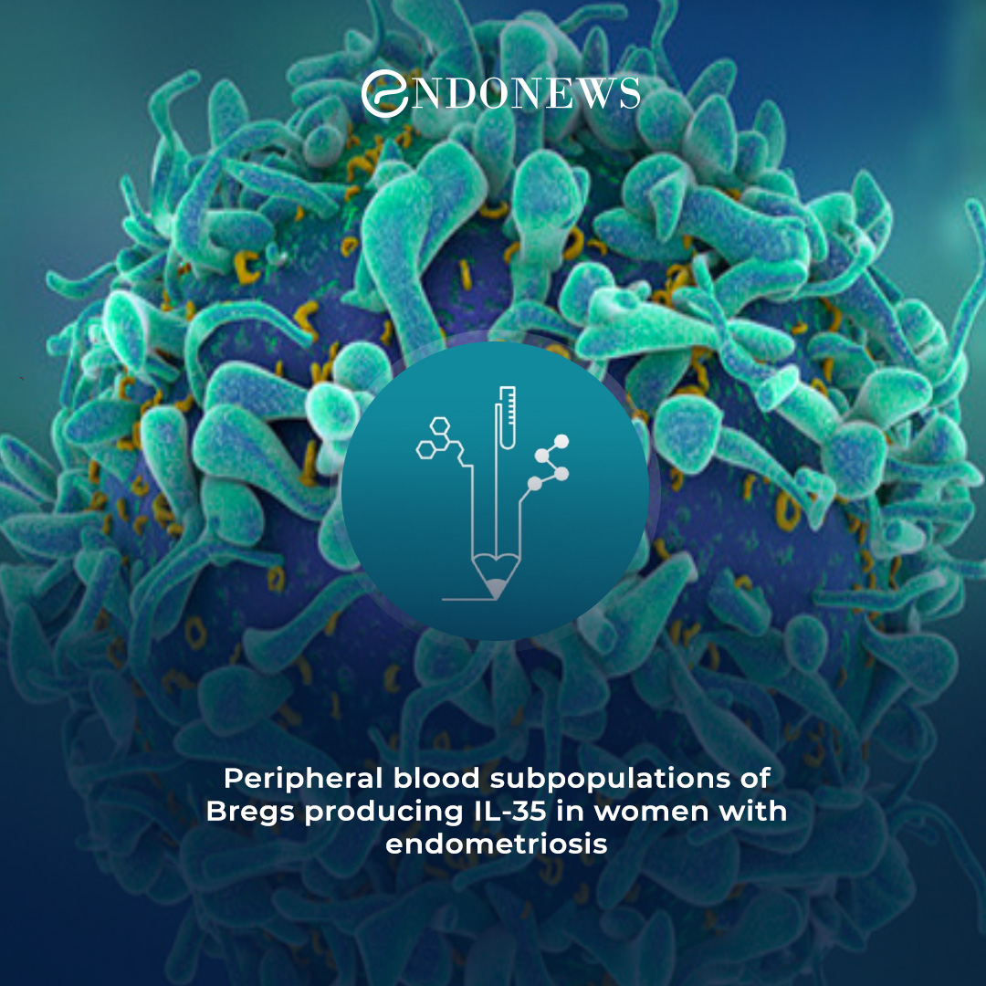 Interleukin-35 expression in B lymphocytes: A new potential biomarker ...