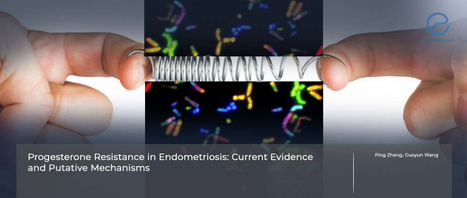 Endometriosis and Progesterone Resistance | EndoNews Endometriosis and Progesterone Resistance | EndoNews