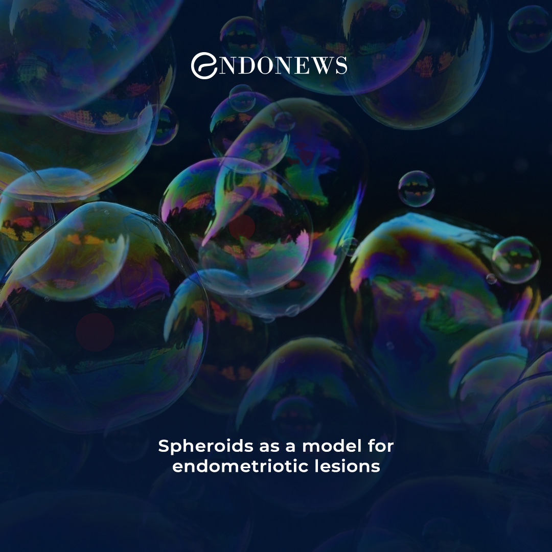Spheroids: 3D-mini-models for Understanding Endometriosis | EndoNews